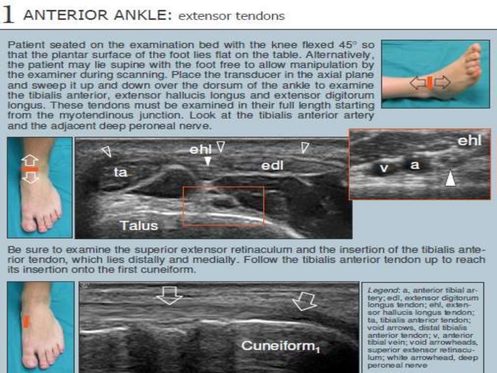 Presentation1 Pptx Ultrasound Examination Of The Ankle Joint