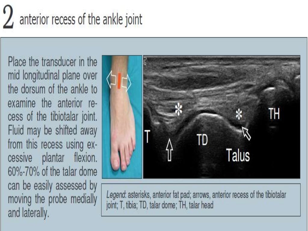 Presentation1 Pptx Ultrasound Examination Of The Ankle Joint