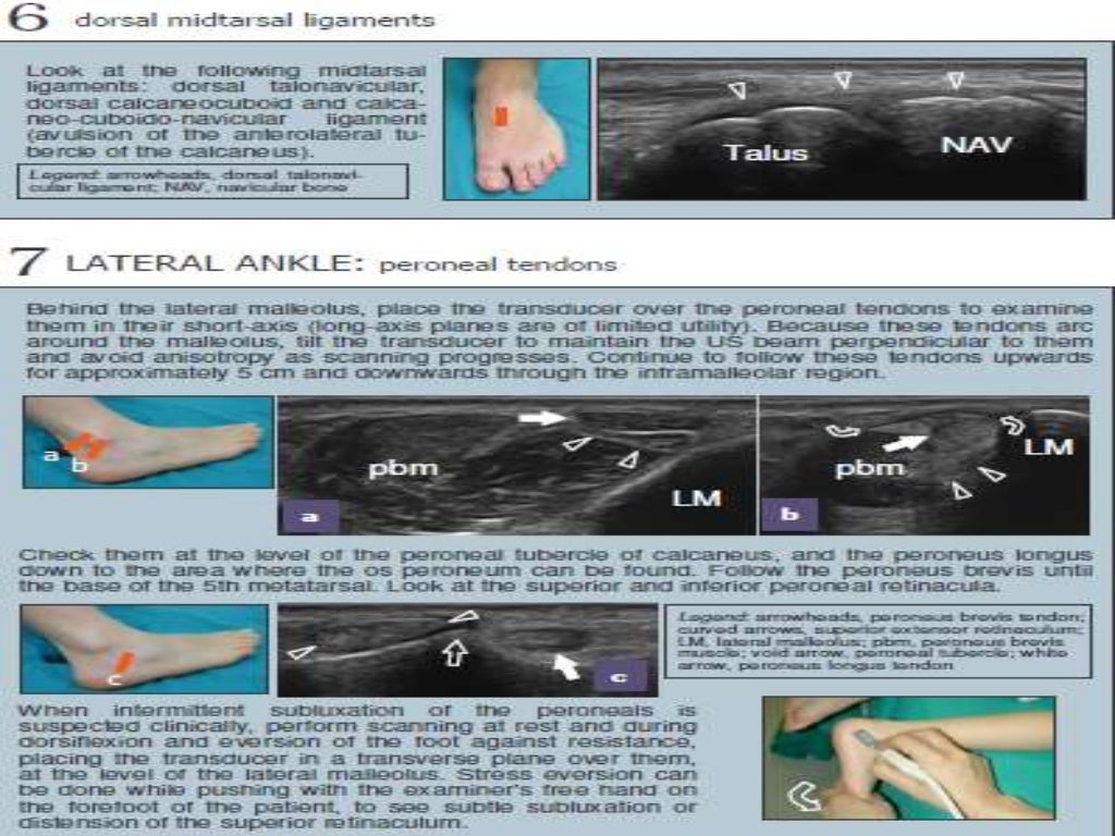 Presentation1 Pptx Ultrasound Examination Of The Ankle Joint