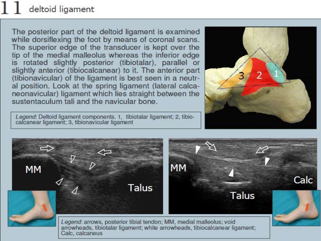 Presentation1 Pptx Ultrasound Examination Of The Ankle Joint