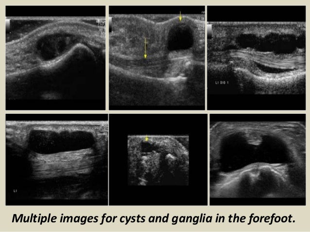 Presentation1.pptx. ultrasound examination of the foot