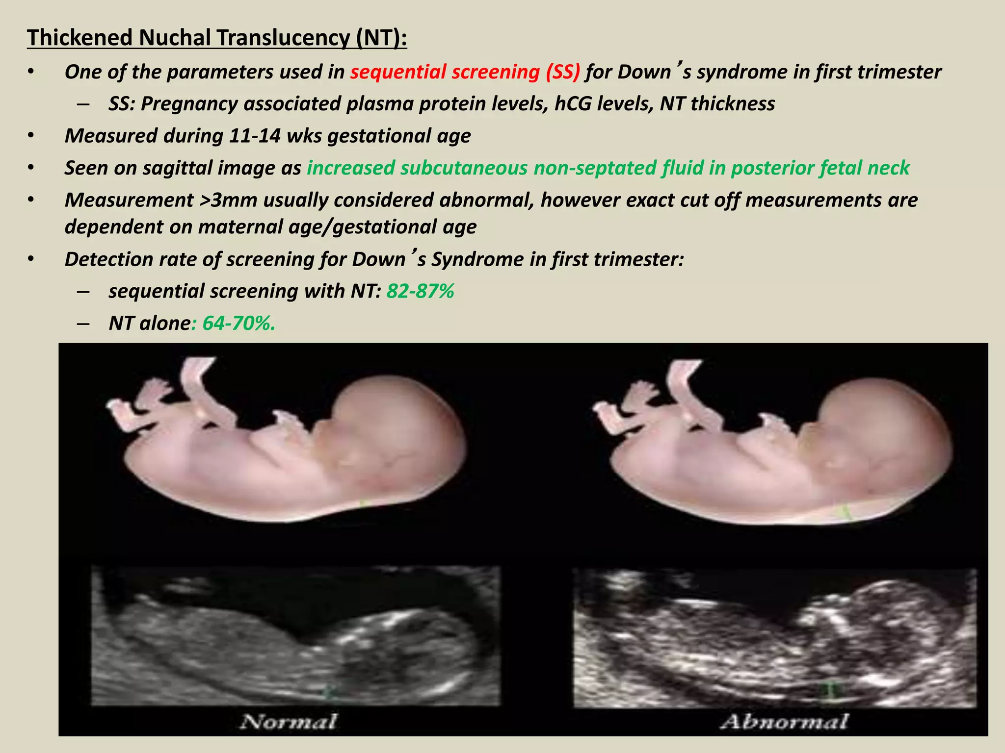 Presentation1.pptx, ultrasound examination of the 1st trimester ...