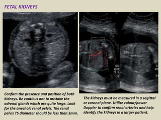 Presentation1.pptx, ultrasound examination of the 2nd & 3rd trimester ...