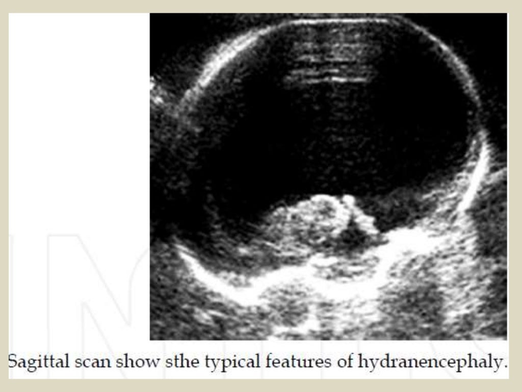 Presentation1 Pptx Ultrasound Examination Of The 2nd And 3rd Trimester…