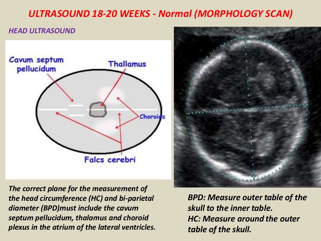 Presentation1 Pptx Ultrasound Examination Of The 2nd And 3rd Trimester…
