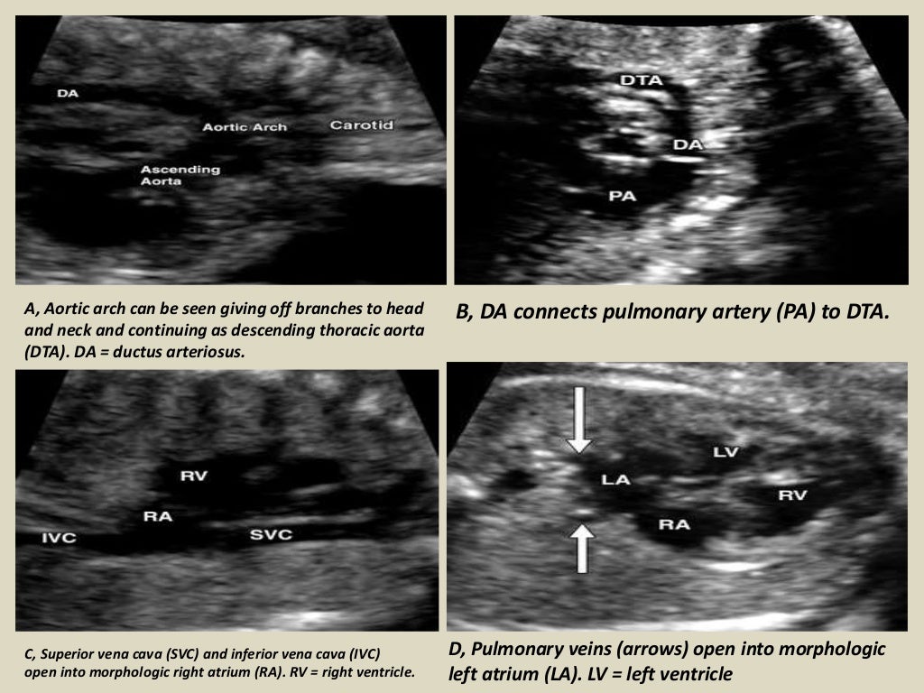 Presentation1 Pptx Ultrasound Examination Of The 2nd And 3rd Trimester…