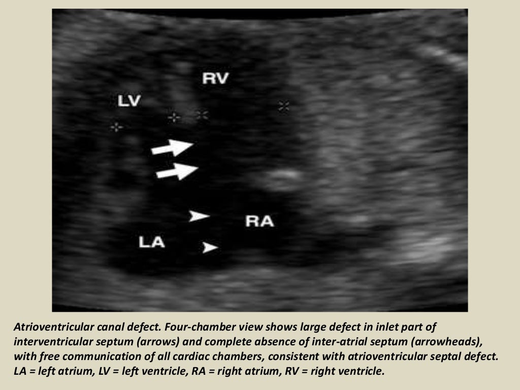Presentation1 Pptx Ultrasound Examination Of The 2nd And 3rd Trimester…