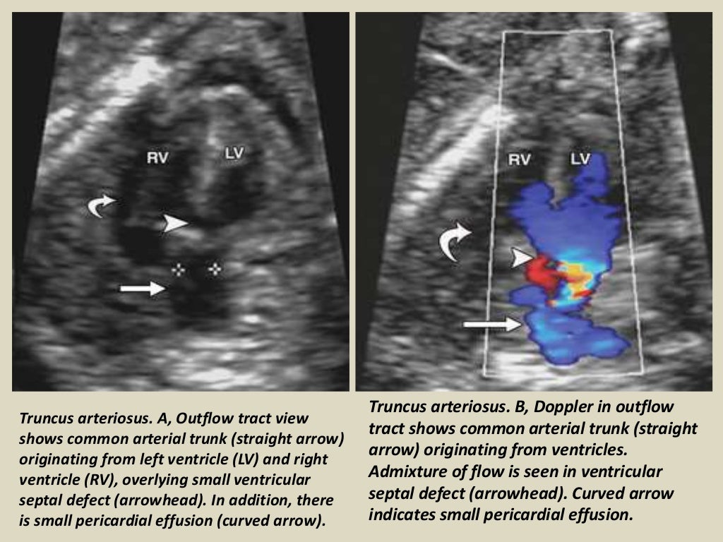 Presentation1 Pptx Ultrasound Examination Of The 2nd And 3rd Trimester…