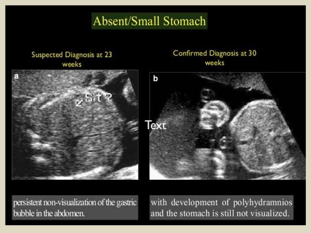 Presentation1 Pptx Ultrasound Examination Of The 2nd And 3rd Trimester…