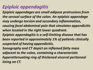 Presentation1.pptx, ultrasound examination of the appendix. | PPTX