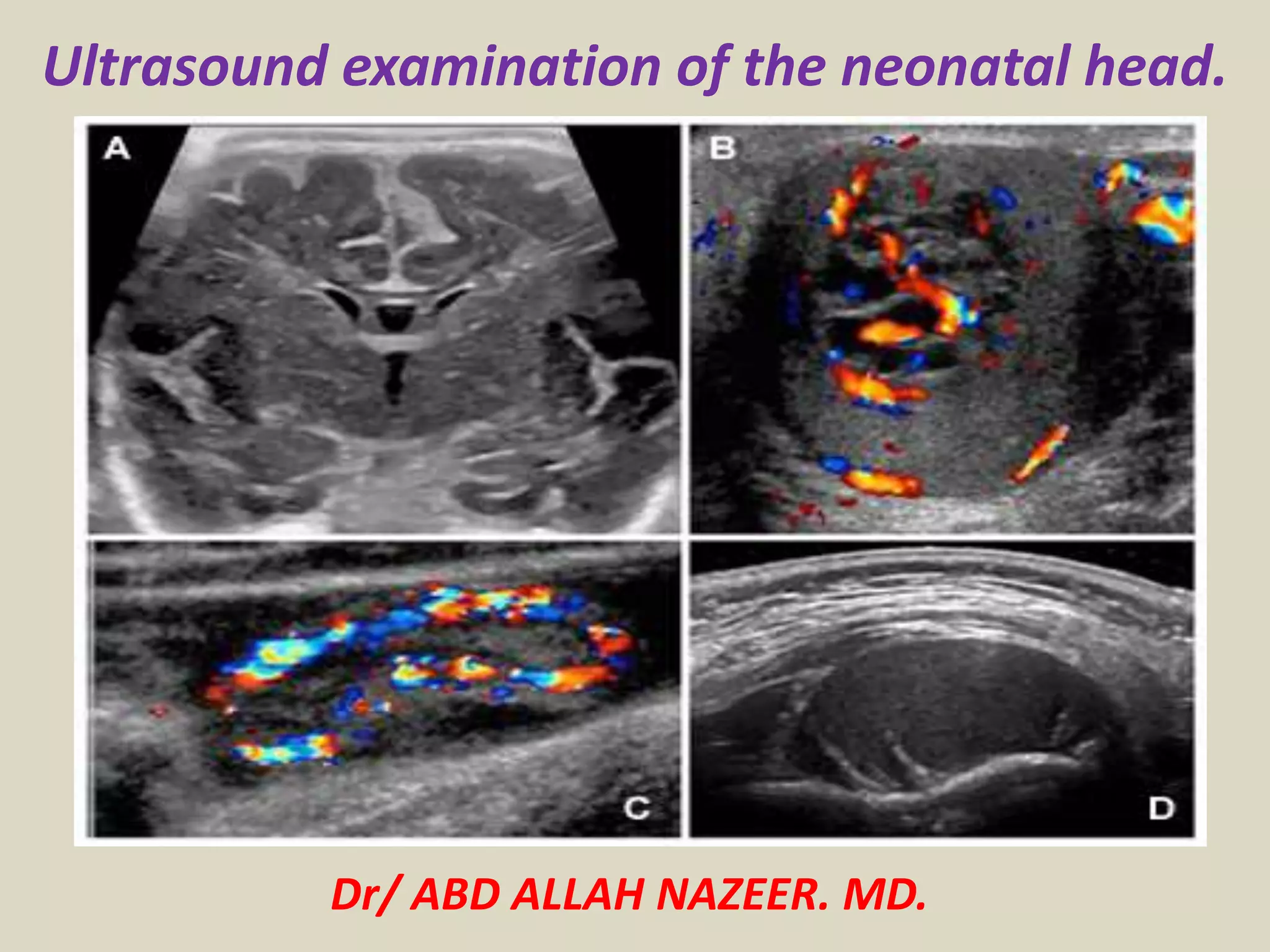 Presentation1.pptx, ultrasound examination of the neonatal head. | PPTX