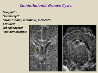 Presentation1.pptx, ultrasound examination of the neonatal head. | PPT