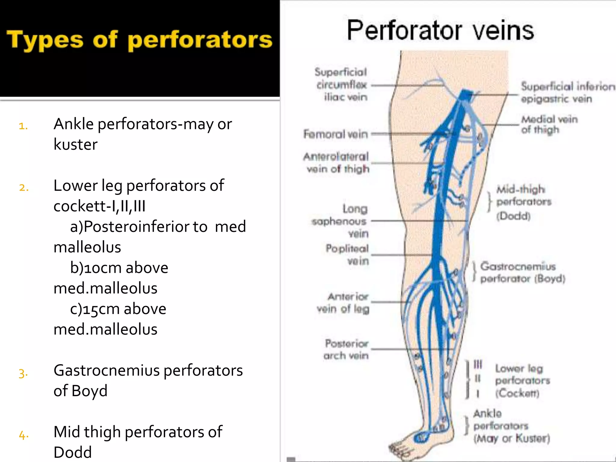 vericose veins | PPTX