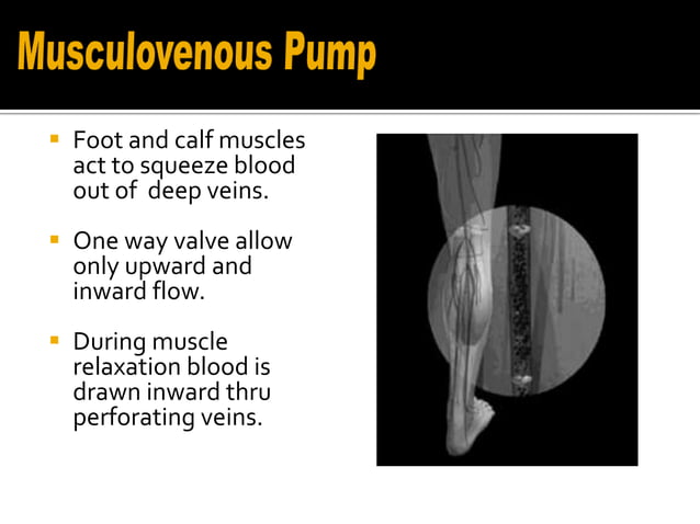 vericose veins | PPT