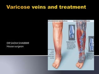 Varicose vein [ chronic venous incompetent.pptx