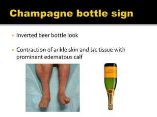 Varicose vein [ chronic venous incompetent.pptx | Free Download