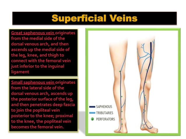 Varicose vein [ chronic venous incompetent.pptx | Free Download