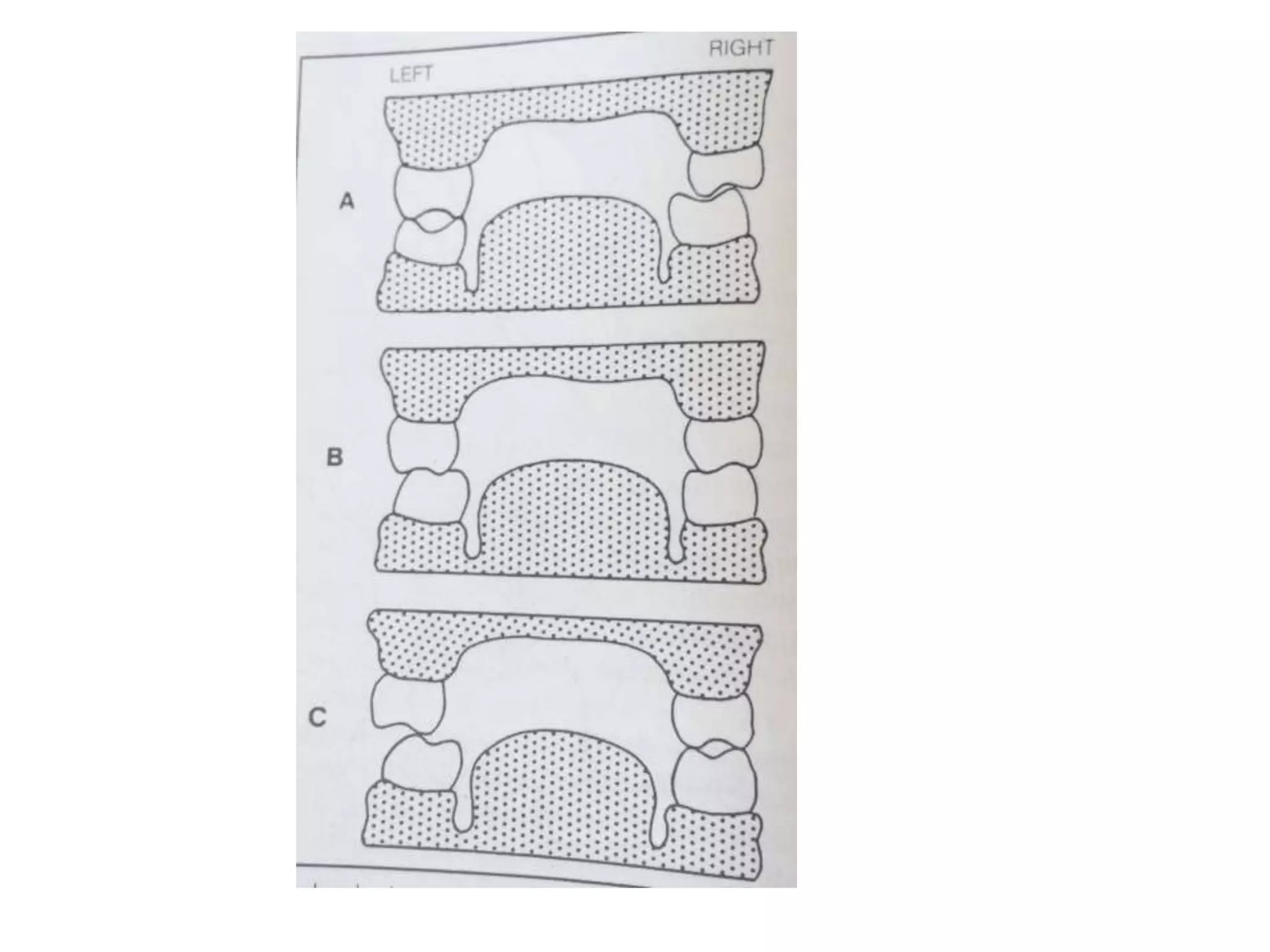 Mastication. Chewing Cycles & Oral Reflexes - Oral Physiology | PPTX