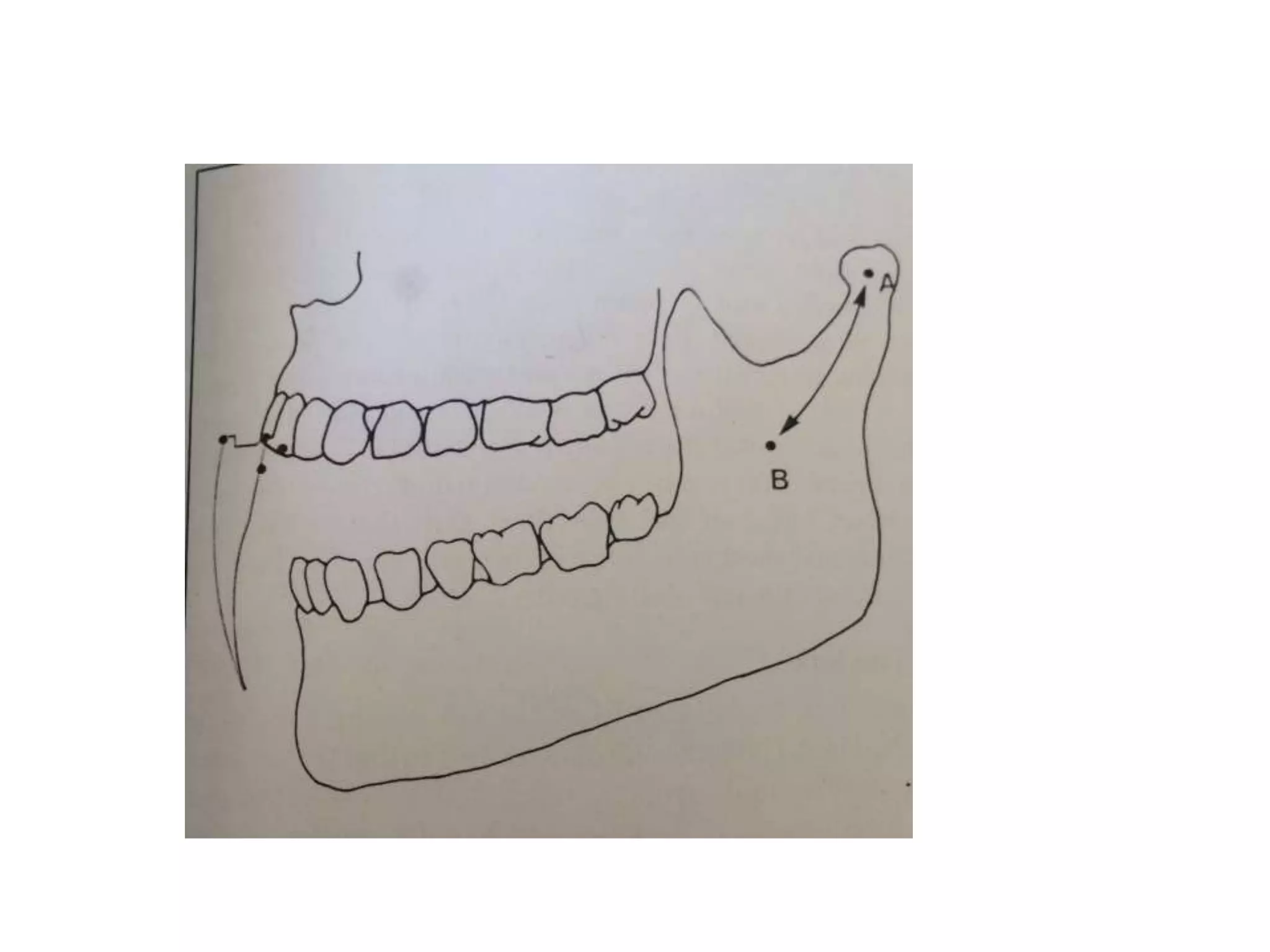 Mastication. Chewing Cycles & Oral Reflexes - Oral Physiology | PPTX