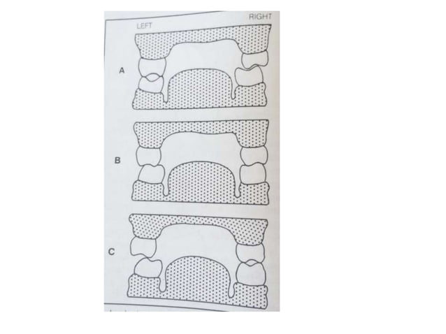 Mastication. Chewing Cycles & Oral Reflexes - Oral Physiology | PPTX