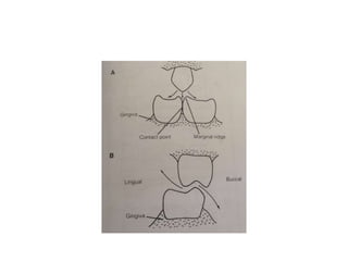 Mastication. Chewing Cycles & Oral Reflexes - Oral Physiology | PPTX