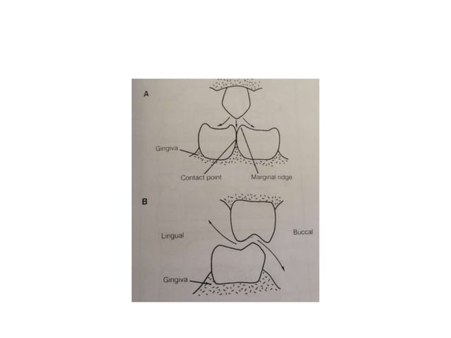 Mastication. Chewing Cycles & Oral Reflexes - Oral Physiology | PPTX