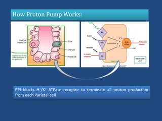 GI System, Ulceration and Role of PPI | PPTX