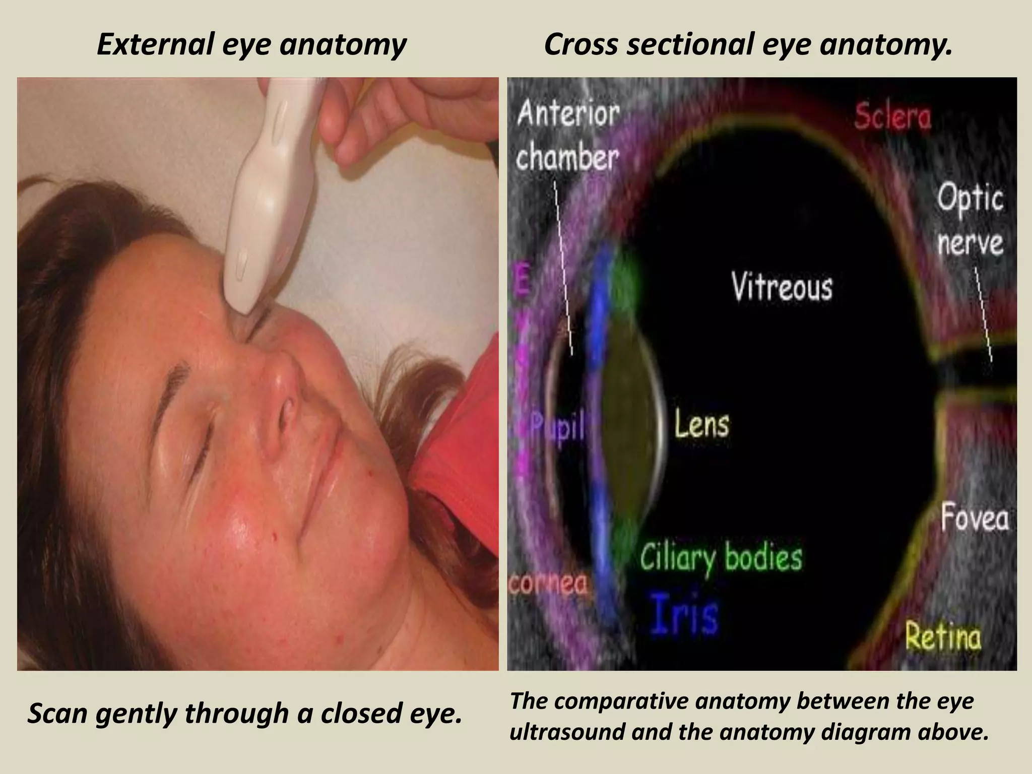 Presentation1.pptx, ultrasound examination of the orbit. | PPTX