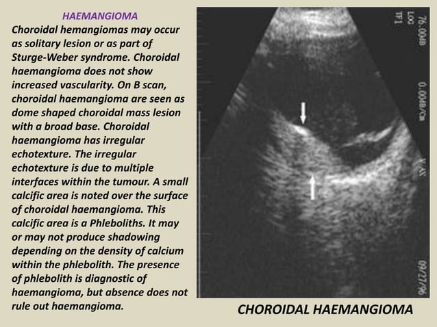Presentation1.pptx, ultrasound examination of the orbit. | PPTX | Eye ...