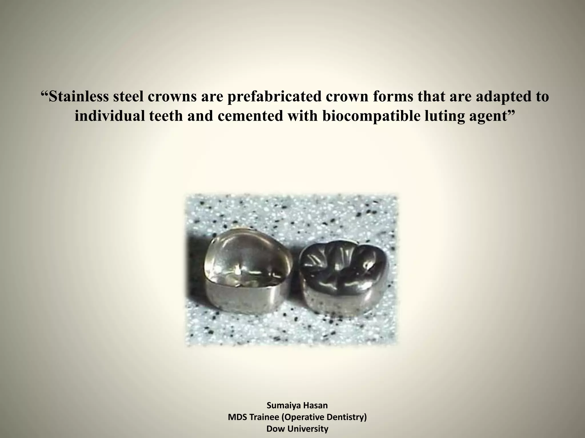 Stainless Steel Crowns In Paediatric Dentistry | PPTX
