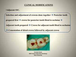 Stainless Steel Crowns In Paediatric Dentistry | PPTX