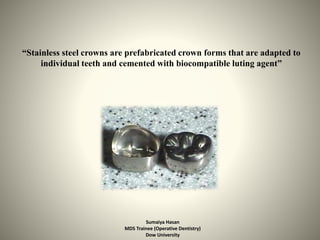 Stainless Steel Crowns In Paediatric Dentistry | PPTX