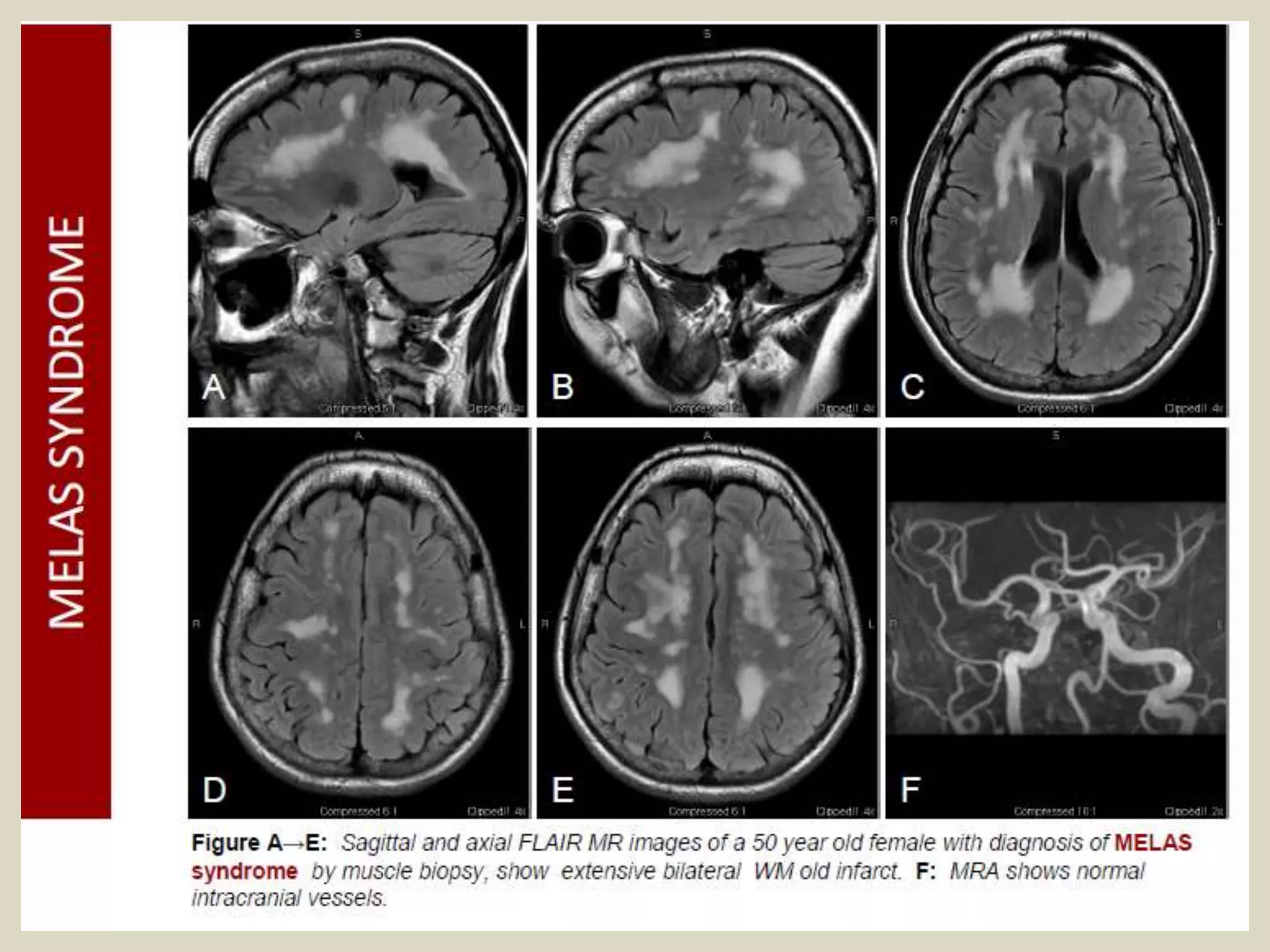 Presentation1.pptx, imaging of genetic diseases. (3) | PPTX