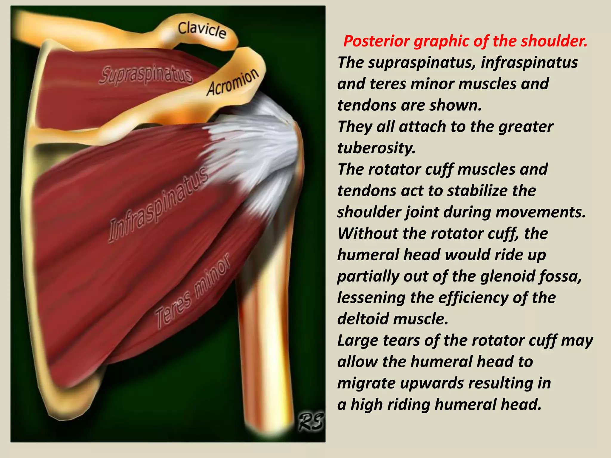 Presentation1.pptx, radiological anatomy of the shoulder joint. | PPTX