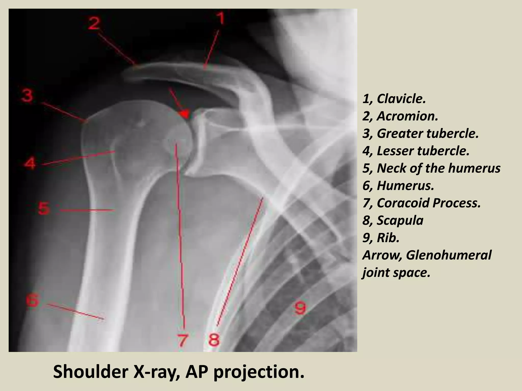 Presentation1.pptx, radiological anatomy of the shoulder joint. | PPTX