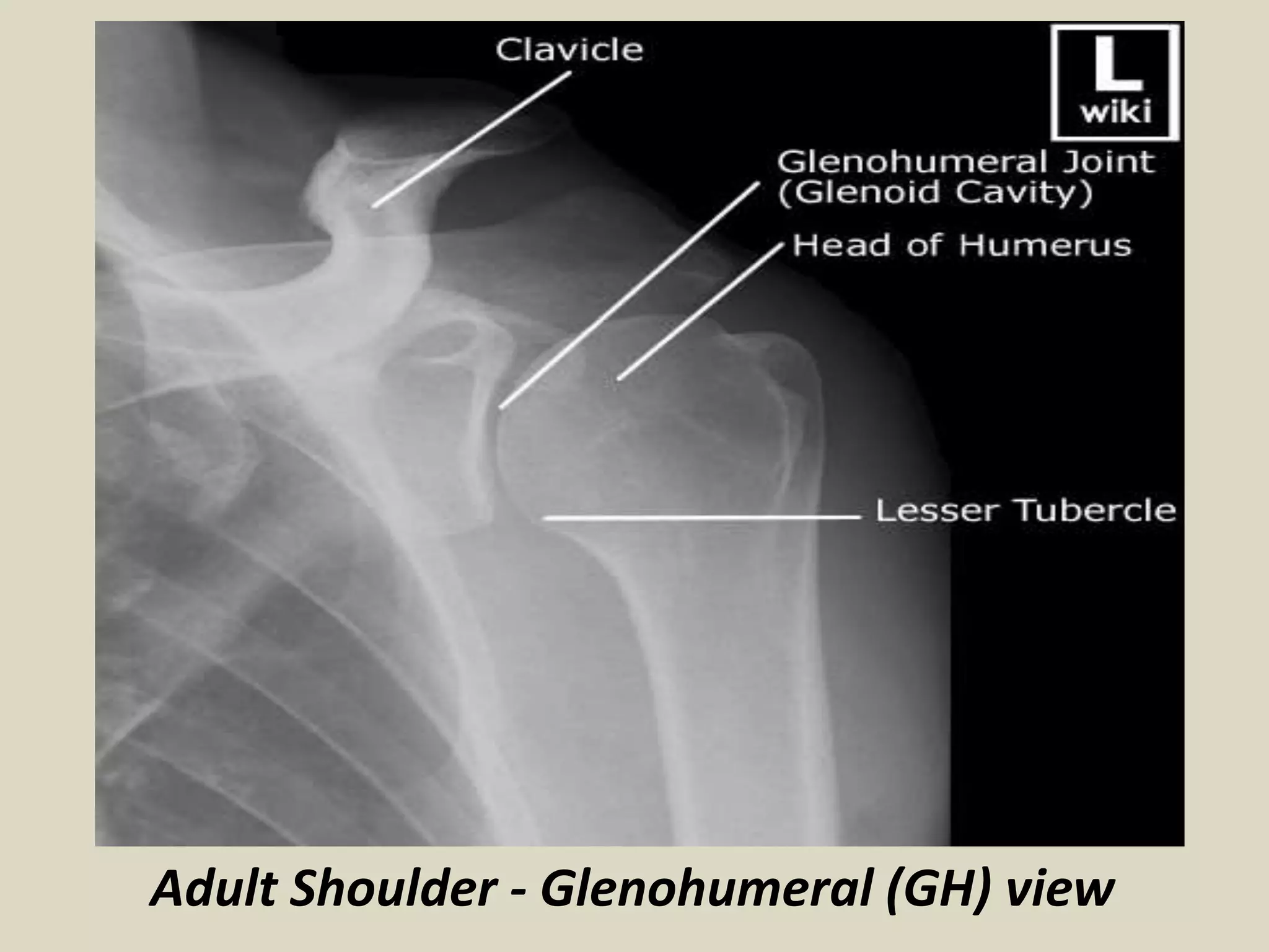Presentation1.pptx, radiological anatomy of the shoulder joint. | PPTX