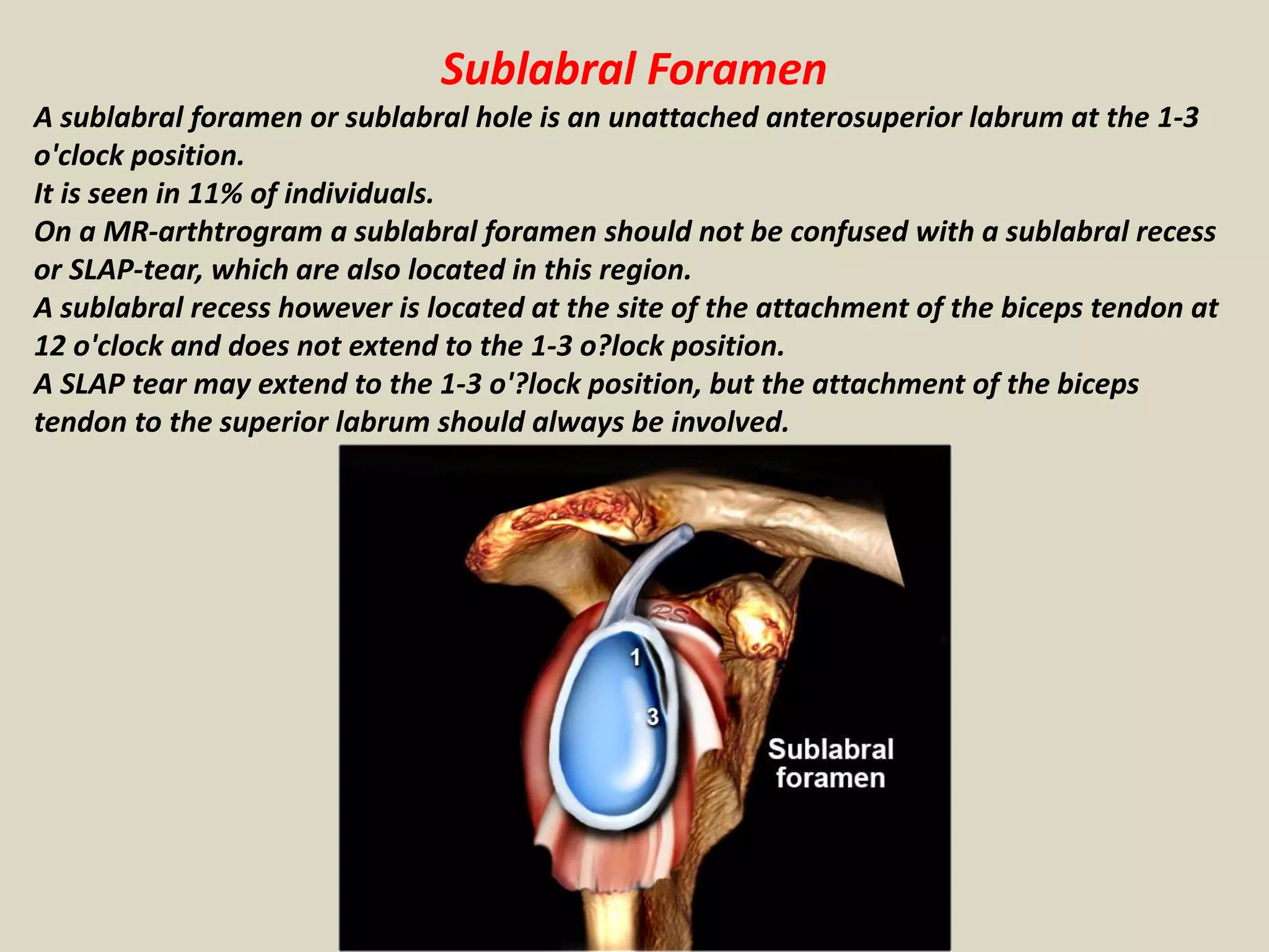 Presentation1.pptx, radiological anatomy of the shoulder joint. | PPTX