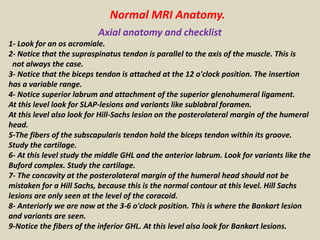 Presentation1.pptx, radiological anatomy of the shoulder joint. | PPTX