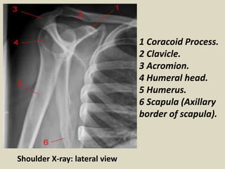 Presentation1.pptx, radiological anatomy of the shoulder joint. | PPTX