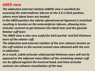 Presentation1.pptx, radiological anatomy of the shoulder joint. | PPTX