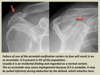 Presentation1.pptx, radiological anatomy of the shoulder joint. | PPTX