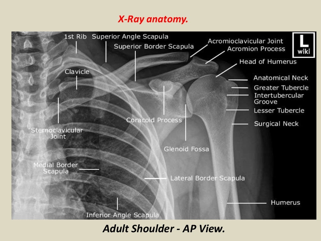 Presentation1.pptx, radiological anatomy of the shoulder joint.