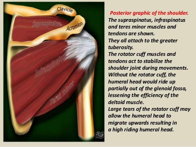 Presentation1.pptx, radiological anatomy of the shoulder joint.