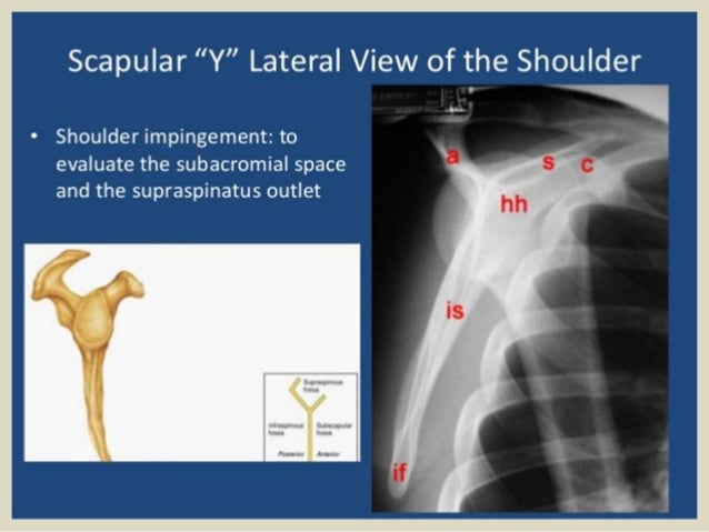 Outlet View Of Shoulder Joint Anatomy | Paul Smith