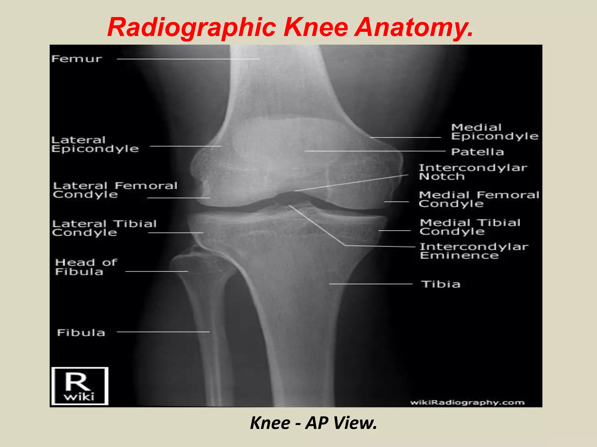 Presentation1.pptx, radiological anatomy of the knee joint. | PPTX