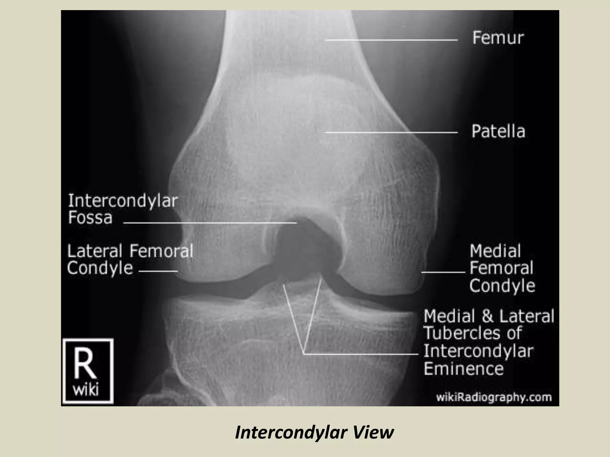 Presentation1.pptx, radiological anatomy of the knee joint. | PPTX