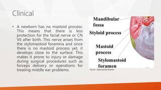 Mastoid Process | PPTX