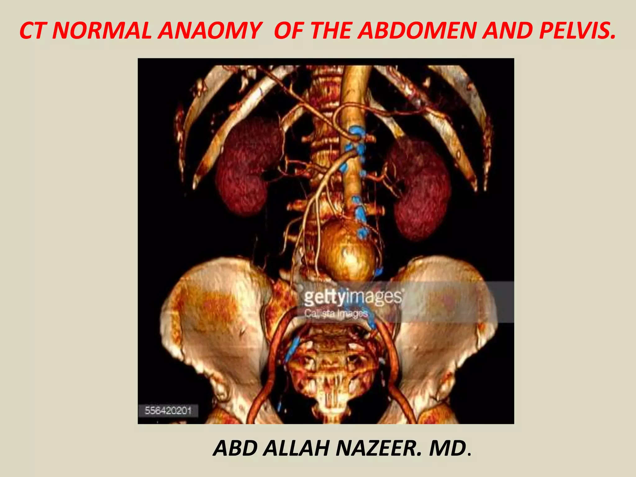 Presentation1.pptx, ct normal anatomy of the abdomen and pelvis. | PPTX