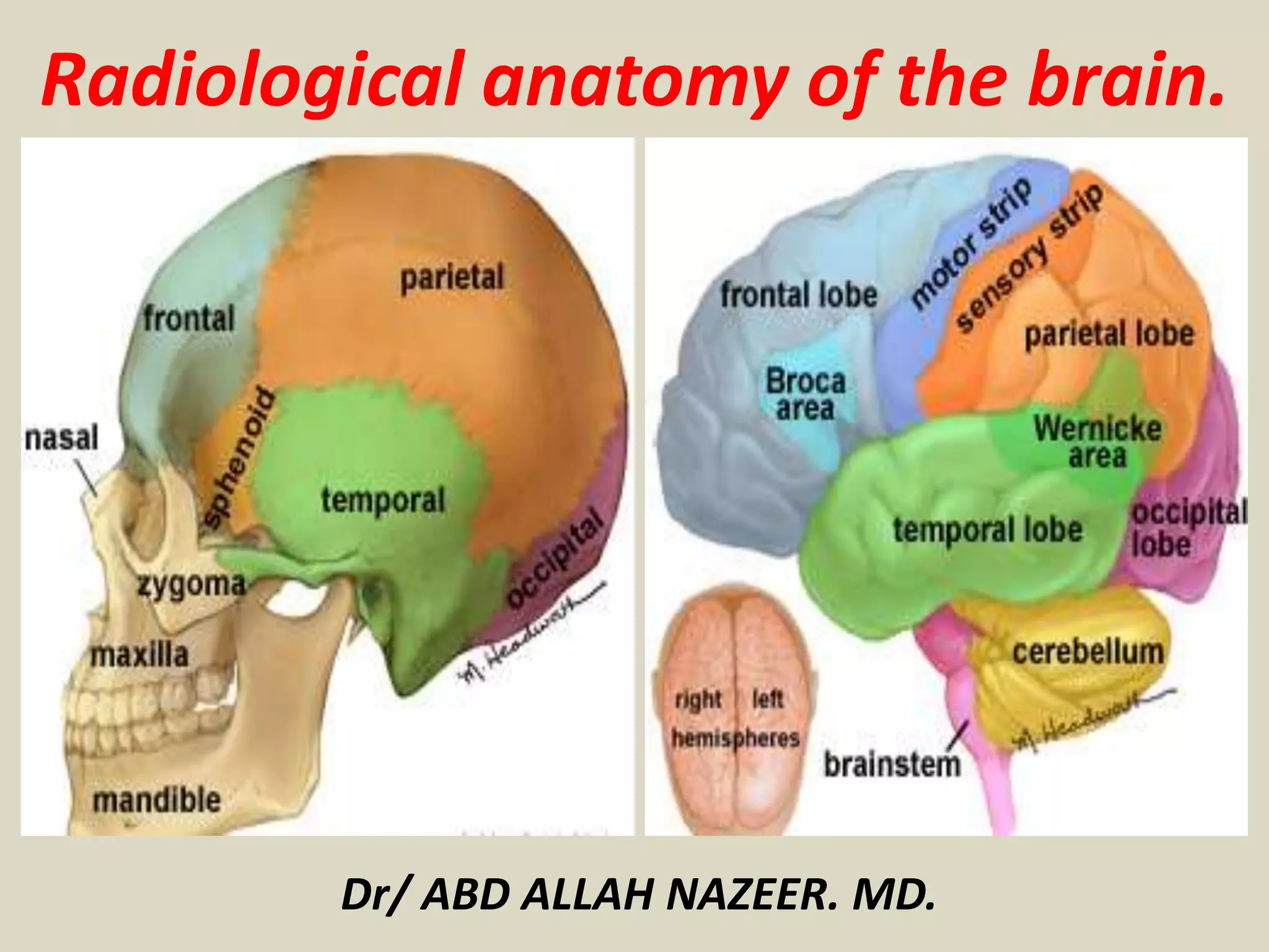 Presentation1.pptx, radiological anatomy of the brain. | PPTX | Brain and Nervous System ...