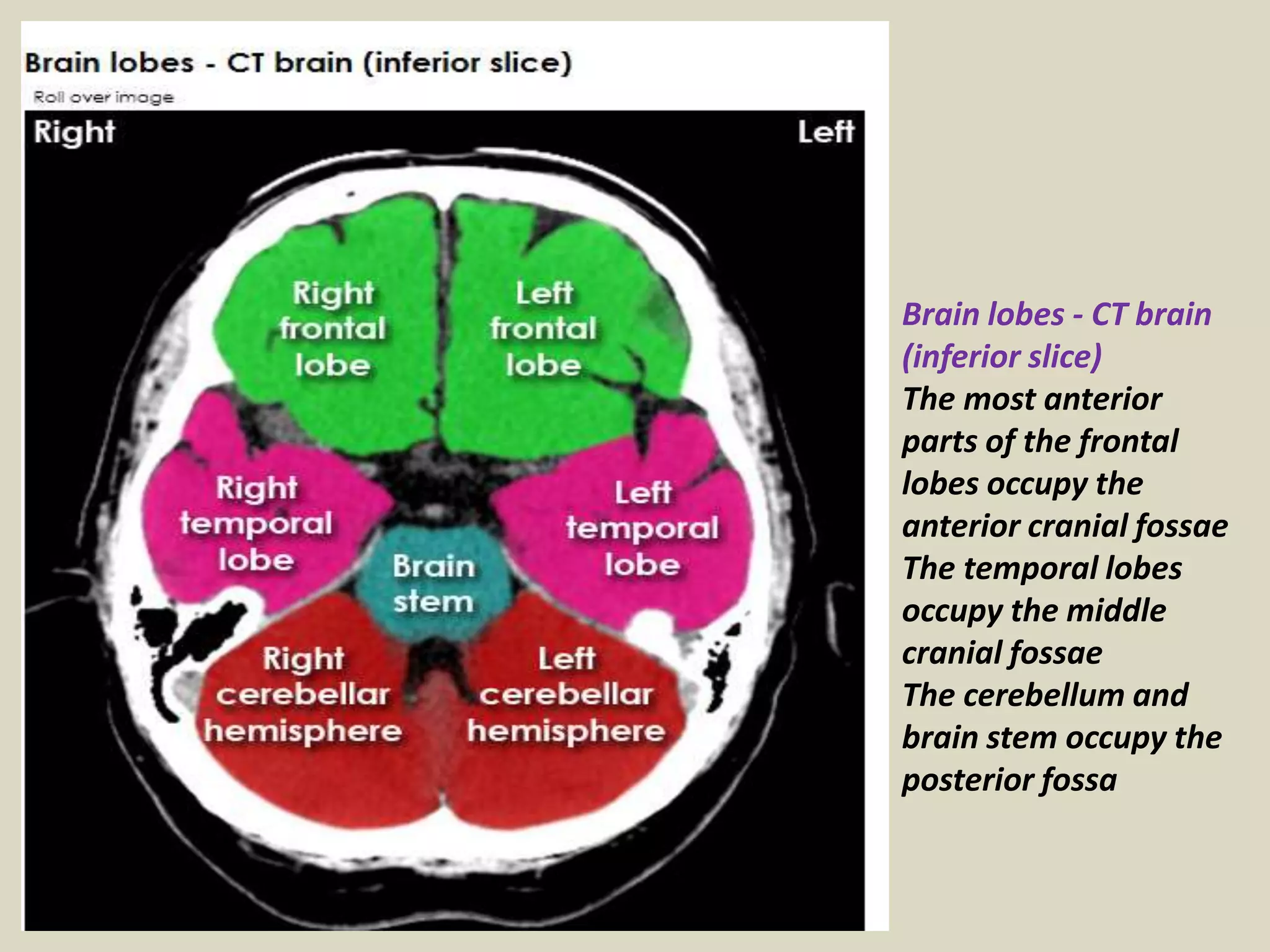 Presentation1.pptx, radiological anatomy of the brain. | PPTX
